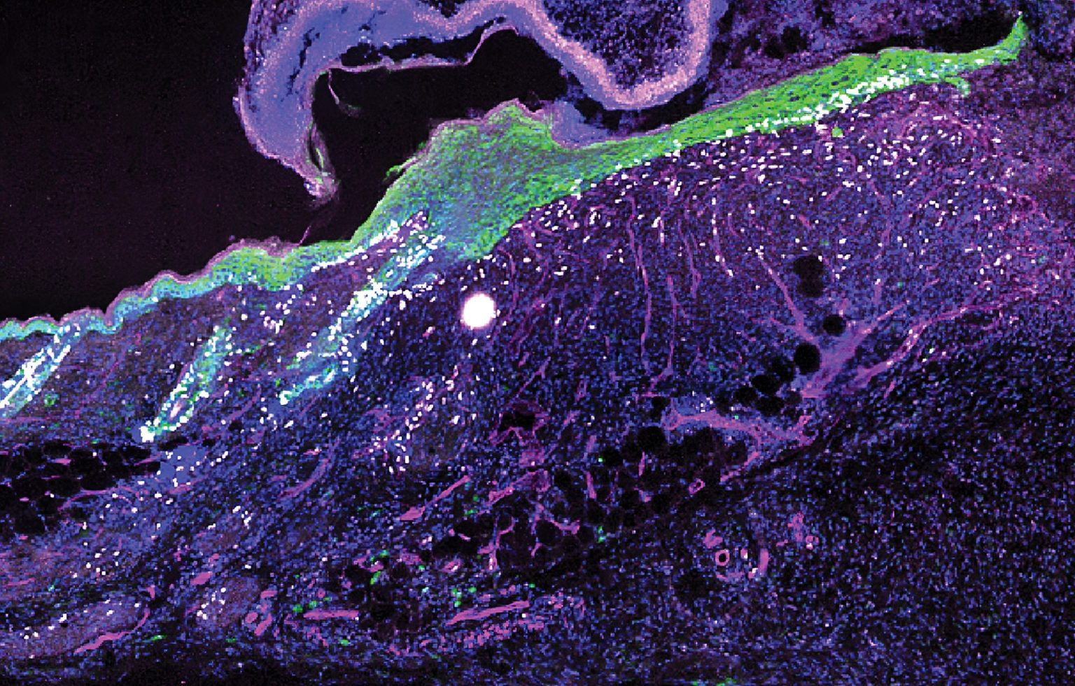 The Skin’s Secret Weapon: Researchers Uncover an Ancient Mechanism for ...
