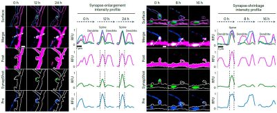 SynapShot Unveiled: Observing the Processes of Memory and Cognition in ...