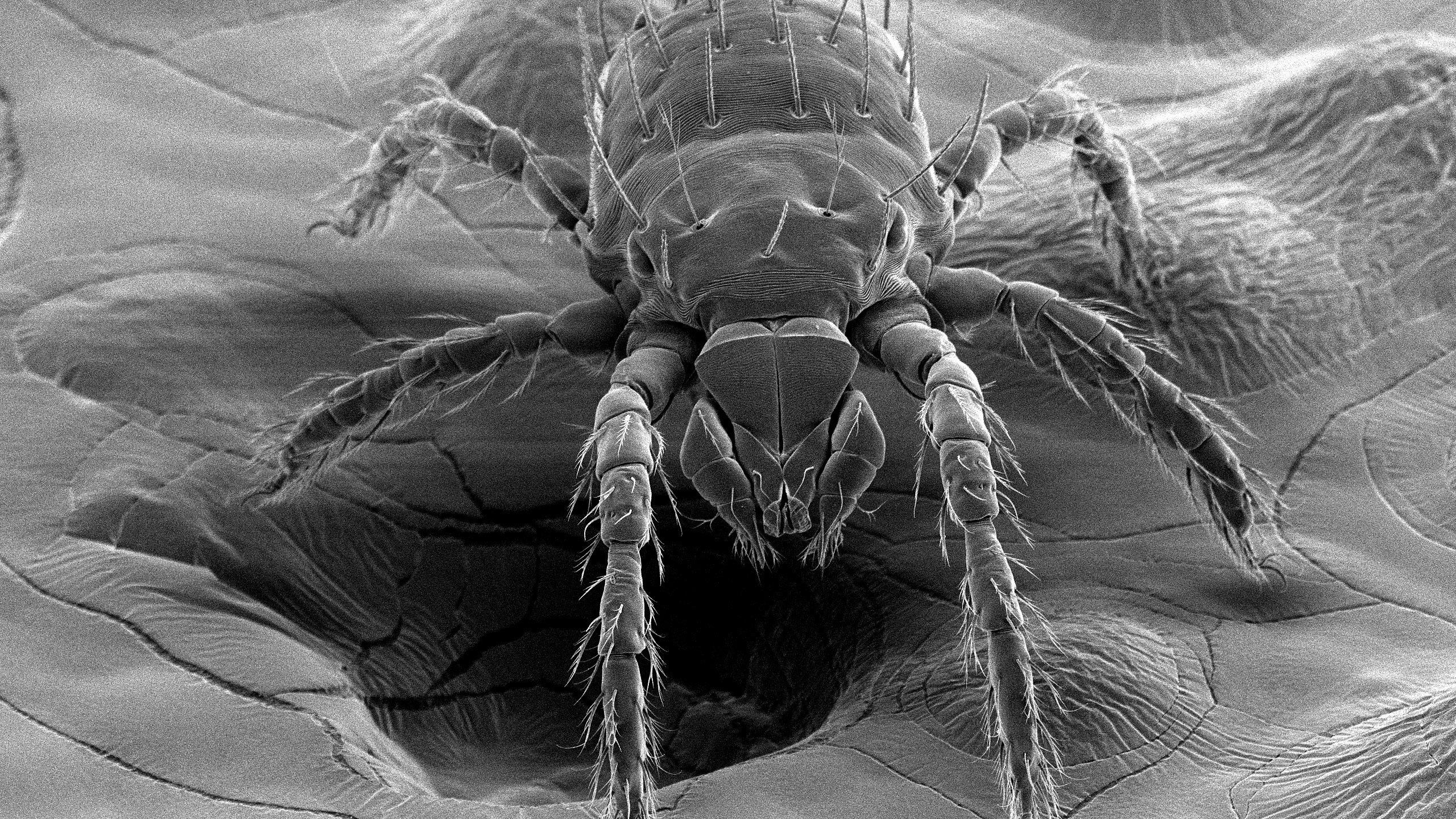 Scrub Typhus Bacteria Detected In NC Chiggers A Public Health Concern Scrub Typhus Bacteria Detected In NC Chiggers A Public Health Concern