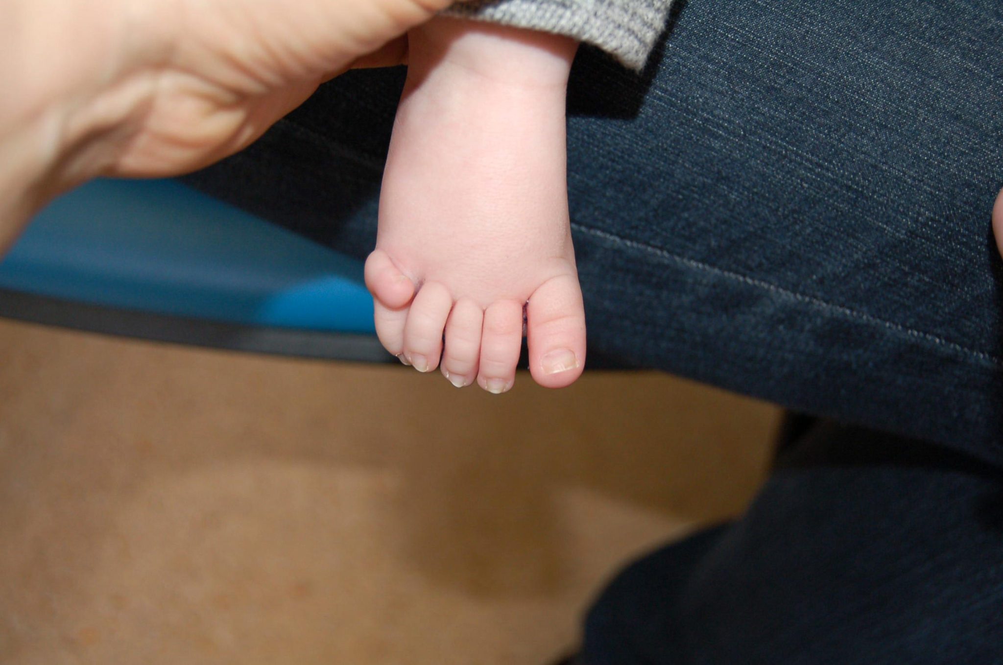 Extra Fingers or Toes? Scientists Pinpoint a Genetic Culprit