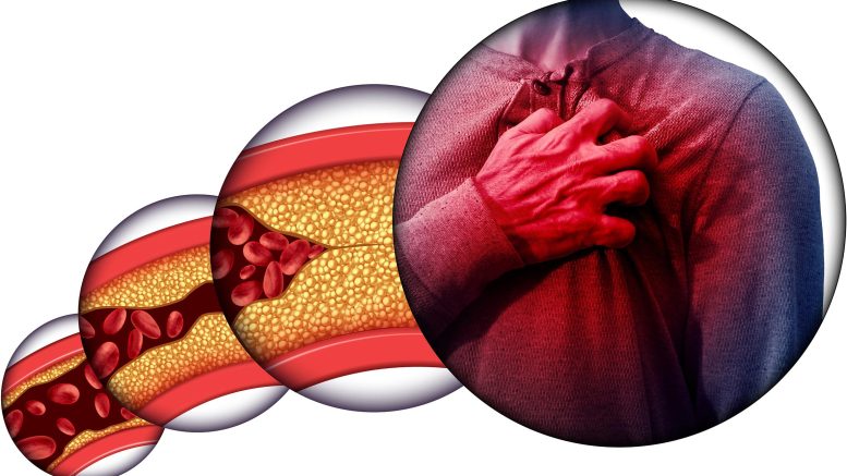 A New Target in the Fight Against Heart Disease