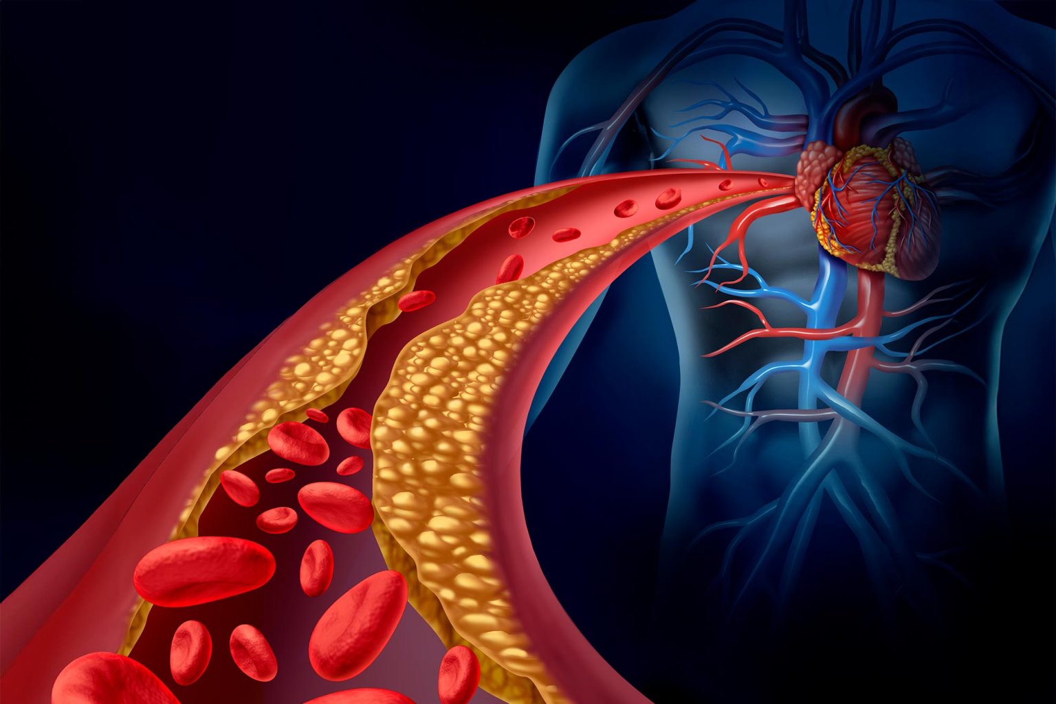UCLA Cholesterol Absorption Breakthrough Could Lead to Innovative ...