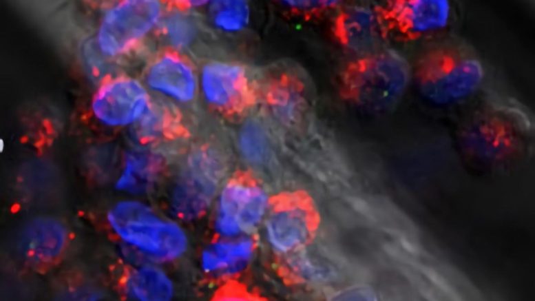 Research Reveals How Tumor Cells Move Throughout the Body