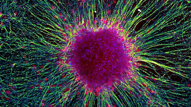 New Protein-Based Sensor Detects Viral Infection, Kills Cancer Cells