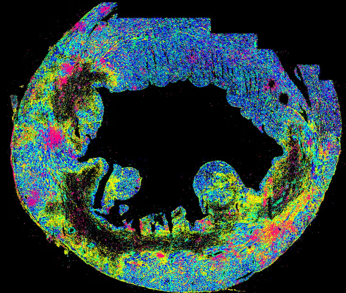 Heart Mystery Solved: Scientists Uncover Surprising Source of Cardiac ...