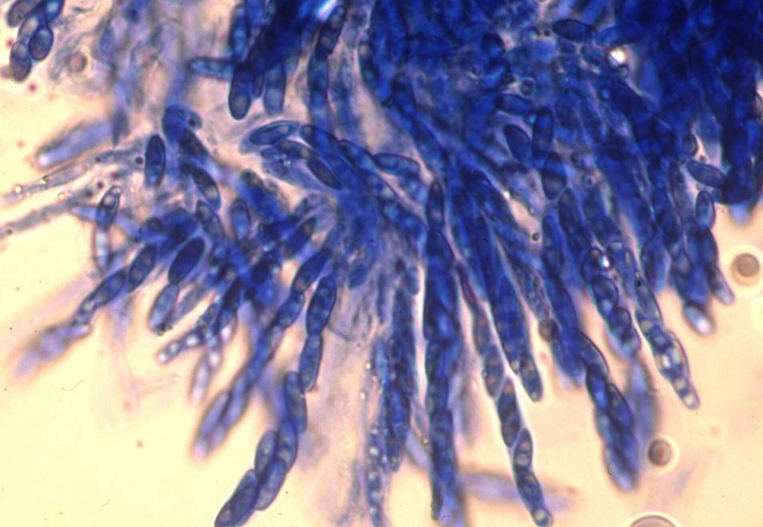 70-Year-Old Coffee-Killing Fungus Brought Back to Life by Scientists ...