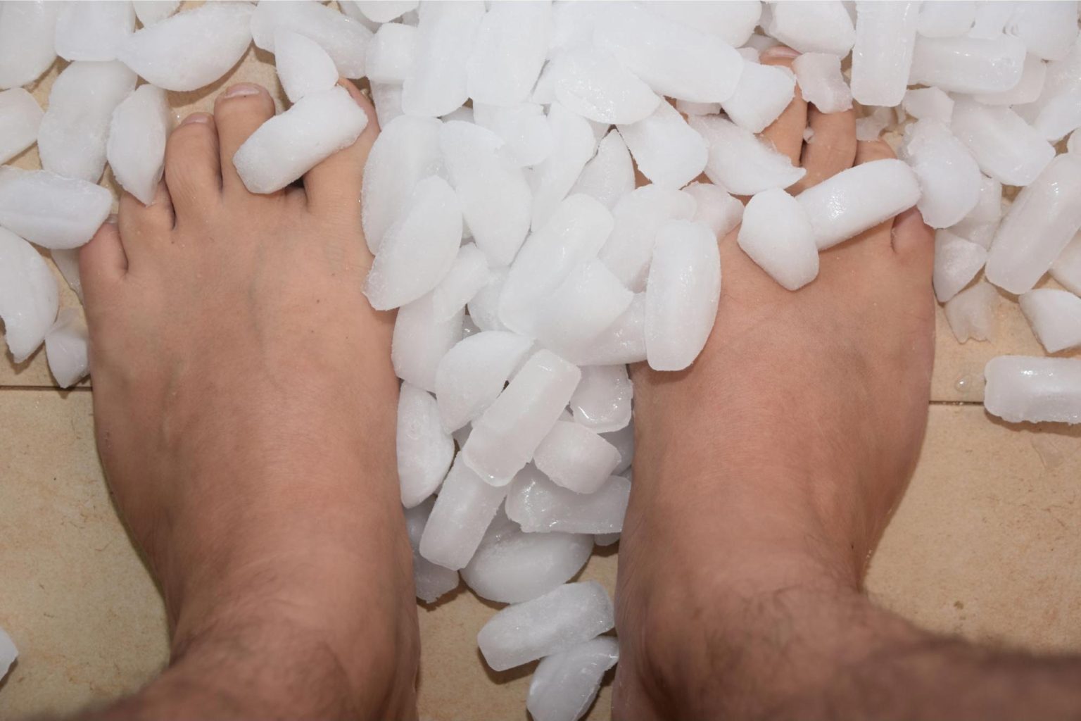 Are Your Feet Always Cold? You Could Have a Serious Vein Problem