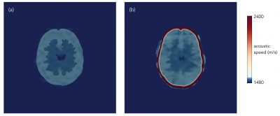 Highly Detailed Images of the Human Brain Using Revolutionary Seismic ...
