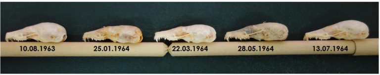 A Rare Phenomenon of Reversible Brain Shrinkage