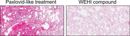 Scientists Discover Drug That Could Finally End Long COVID Suffering