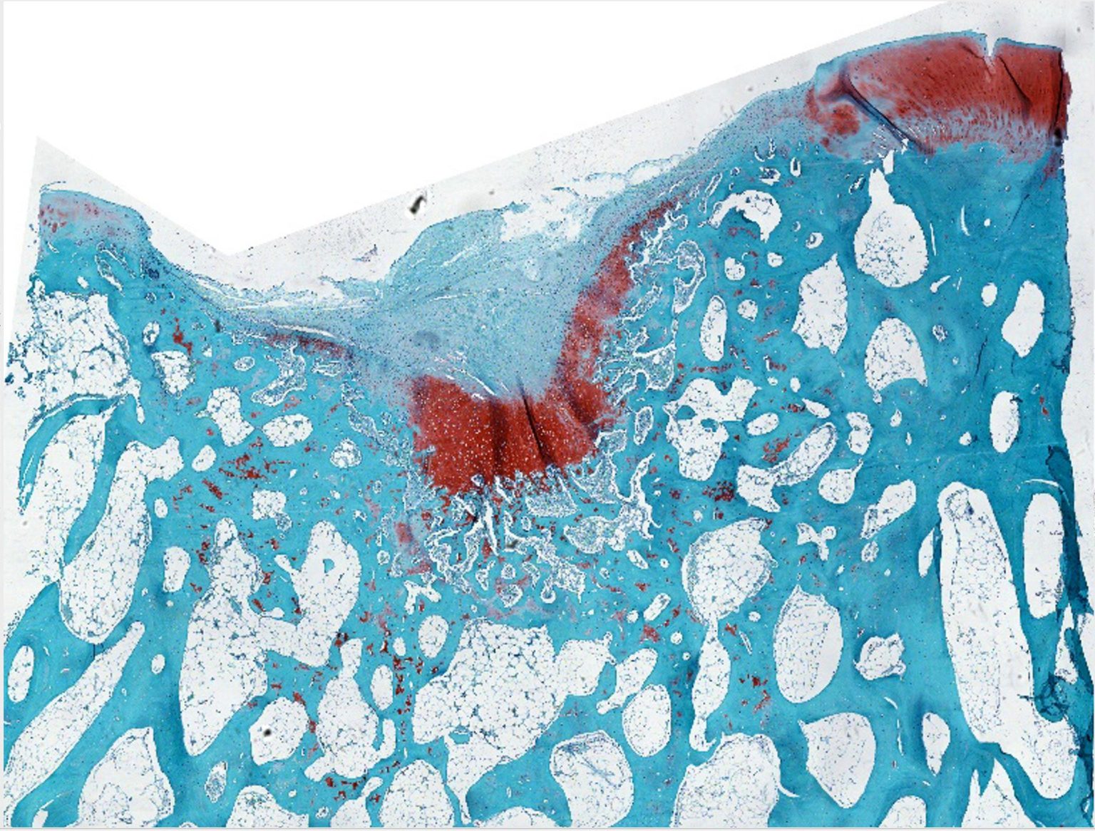 Cartilage Regeneration Breakthrough Ushers In a New Era of Joint Health