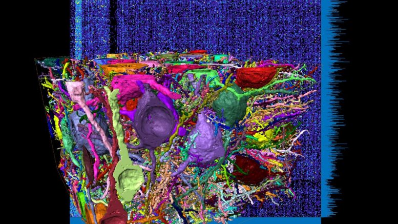 Neurologists Speed Up Connectome Analysis by More Than 10-Fold