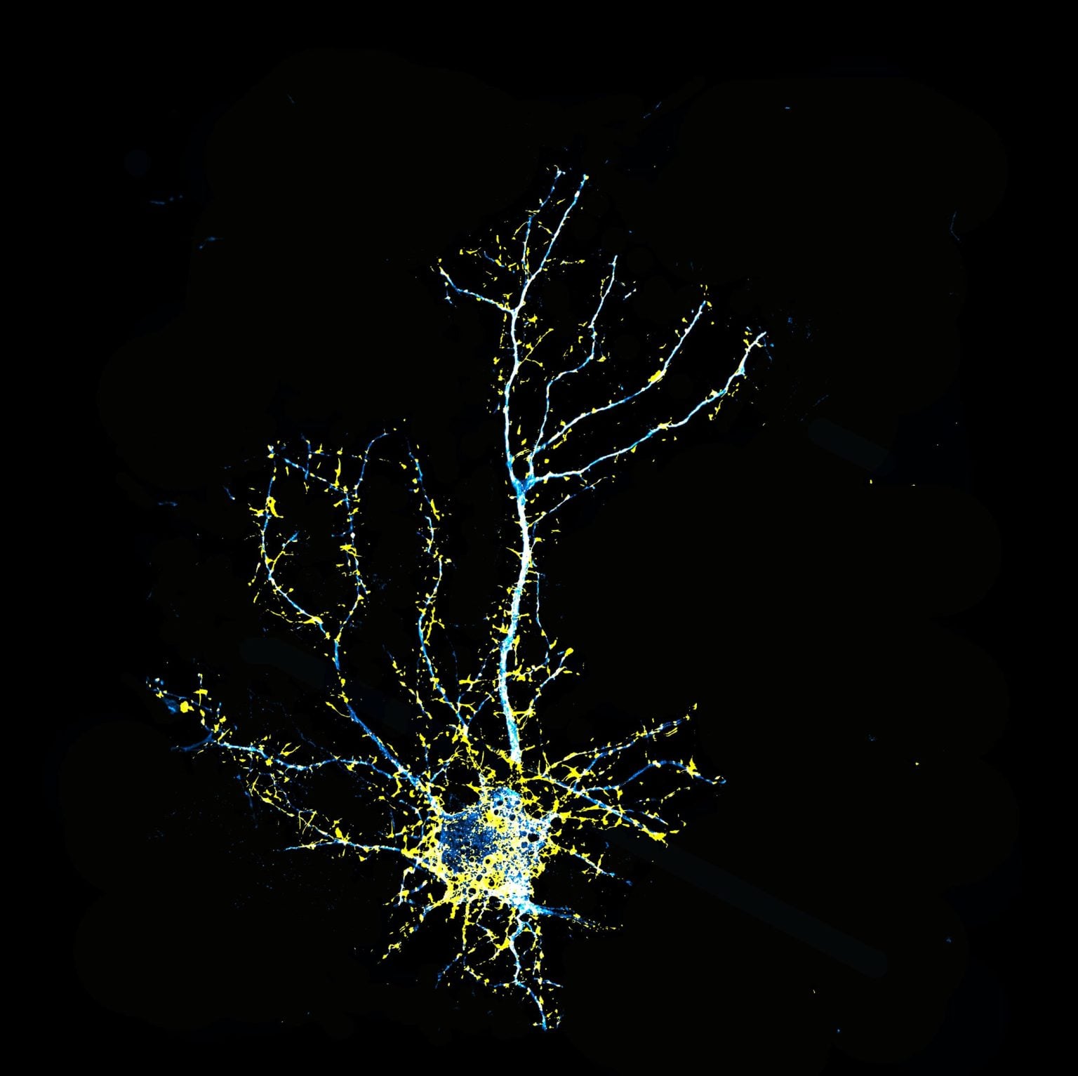 Scientists Flip Two Atoms in LSD – And Unlock a Game-Changing Mental ...