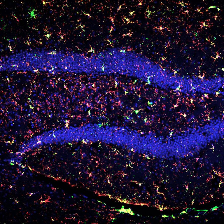 Neuroscientists Identify the First Potential Treatment for Cosmic Radiation