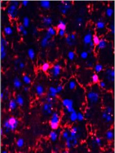 Neuroscientists Identify the First Potential Treatment for Cosmic Radiation