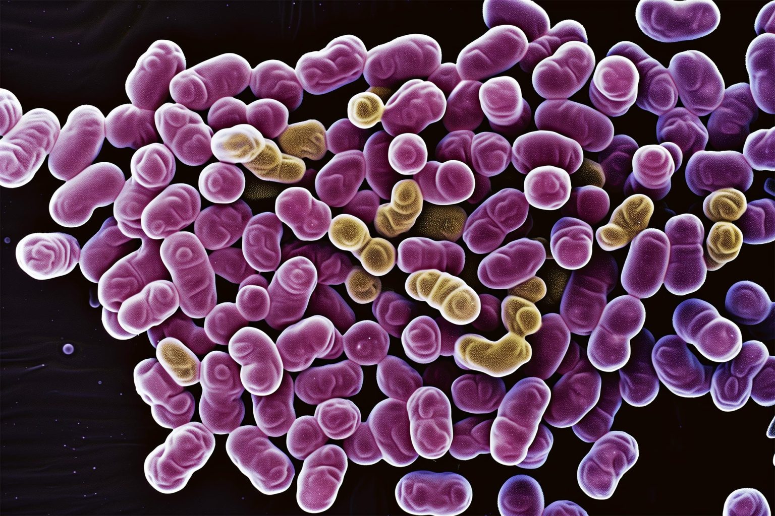 This Superbug Evolved a Genetic Weapon and Took Over Hospitals Worldwide
