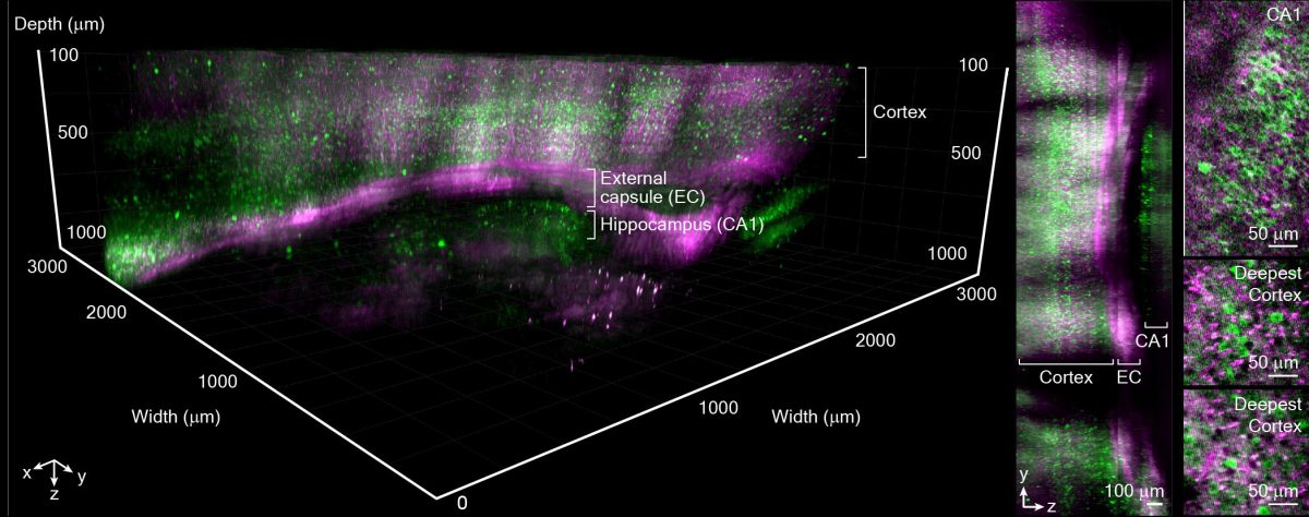 Revolutionary Microscope Unveils the Brain’s Deepest Secrets