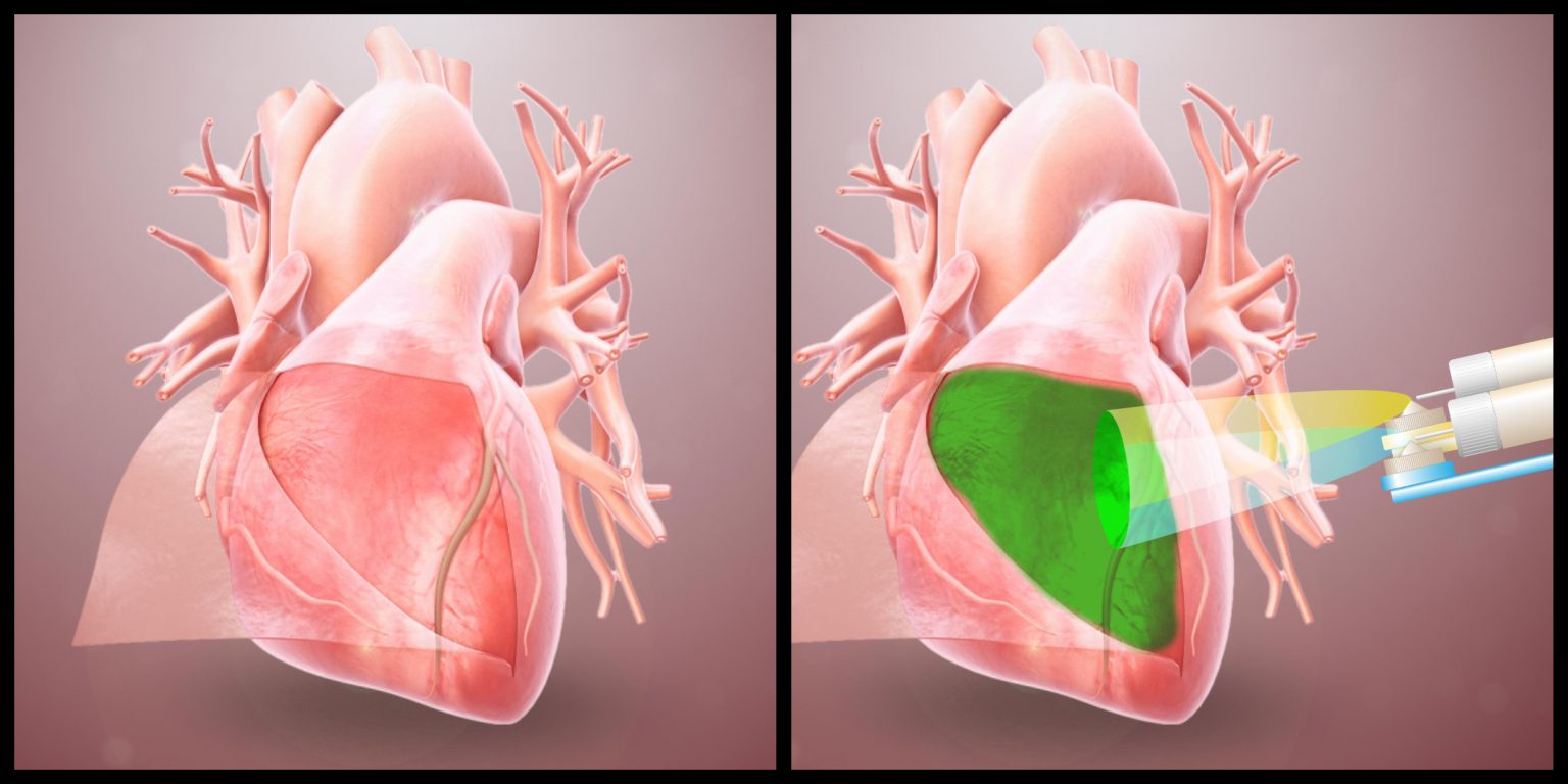 Bio-Inspired Hydrogel Protects the Heart From Adhering to Surrounding ...