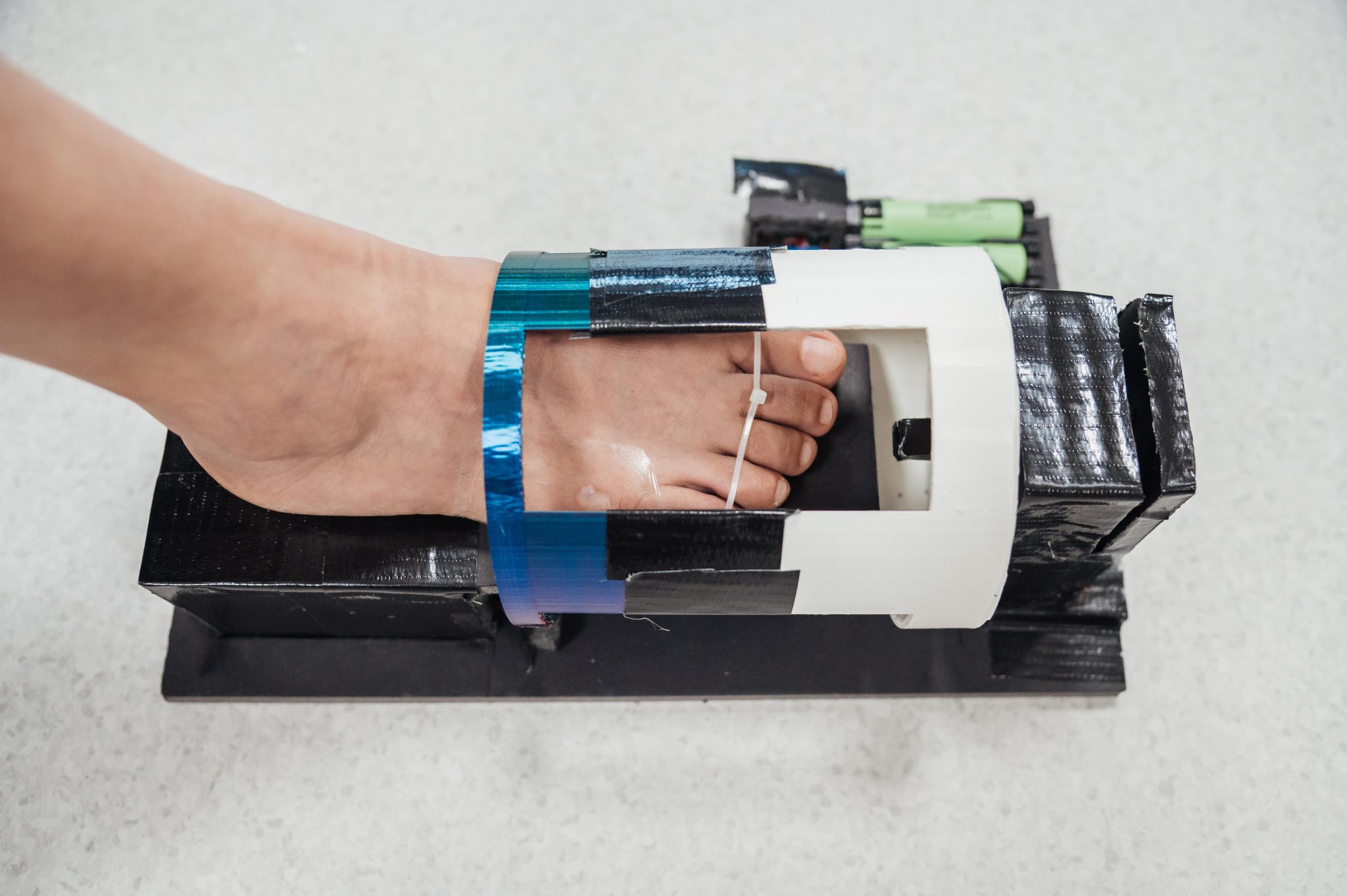 Scientists Develop New Gel That Heals Diabetic Wounds 3x Faster