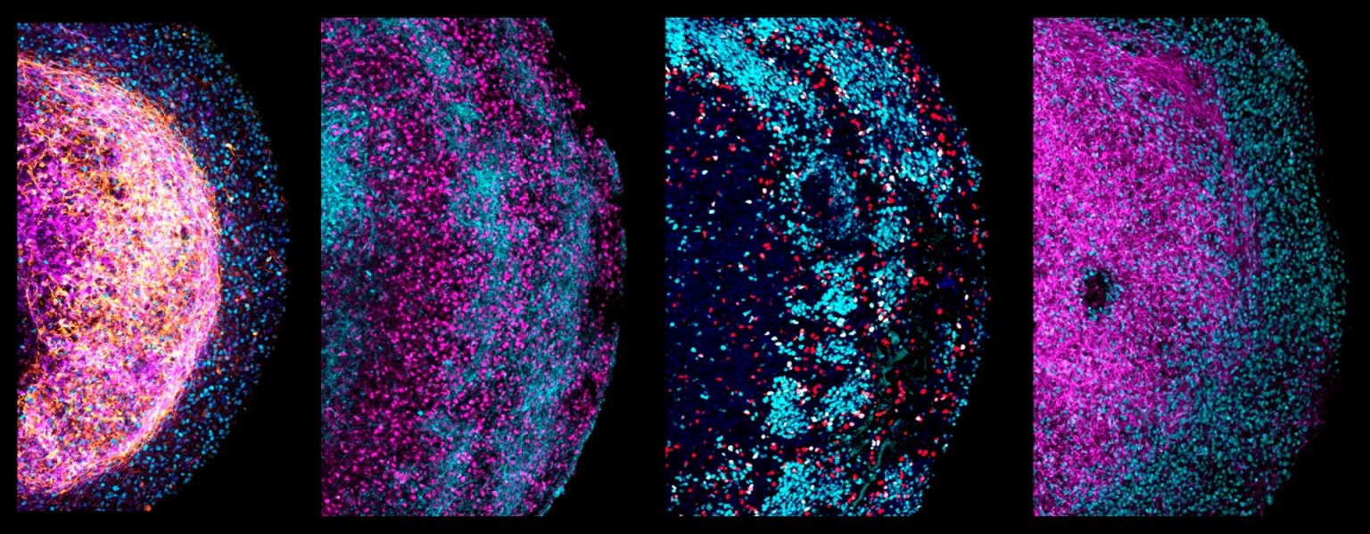 Not Sci-Fi: Scientists Develop Brain Organoids From Fetal Tissue to ...