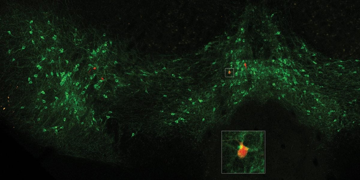 How Dopamine Flips the Brain’s Fear Switch – And Turns On Calm