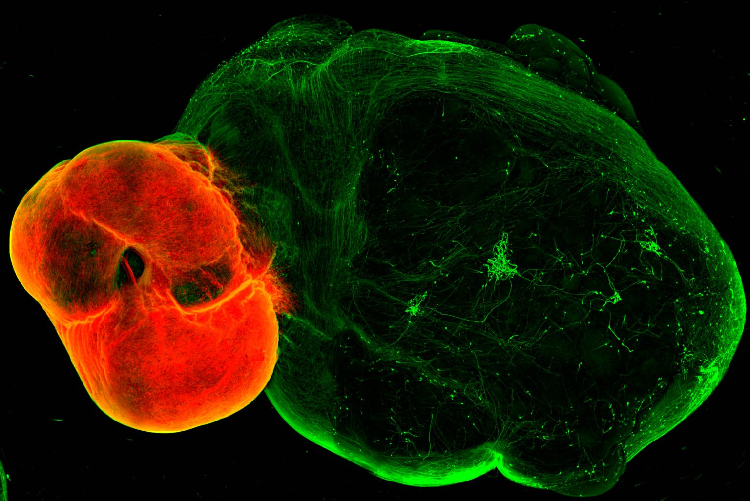 Brain’s Reward Pathway Unlocked: Revealing the Secrets of the ...