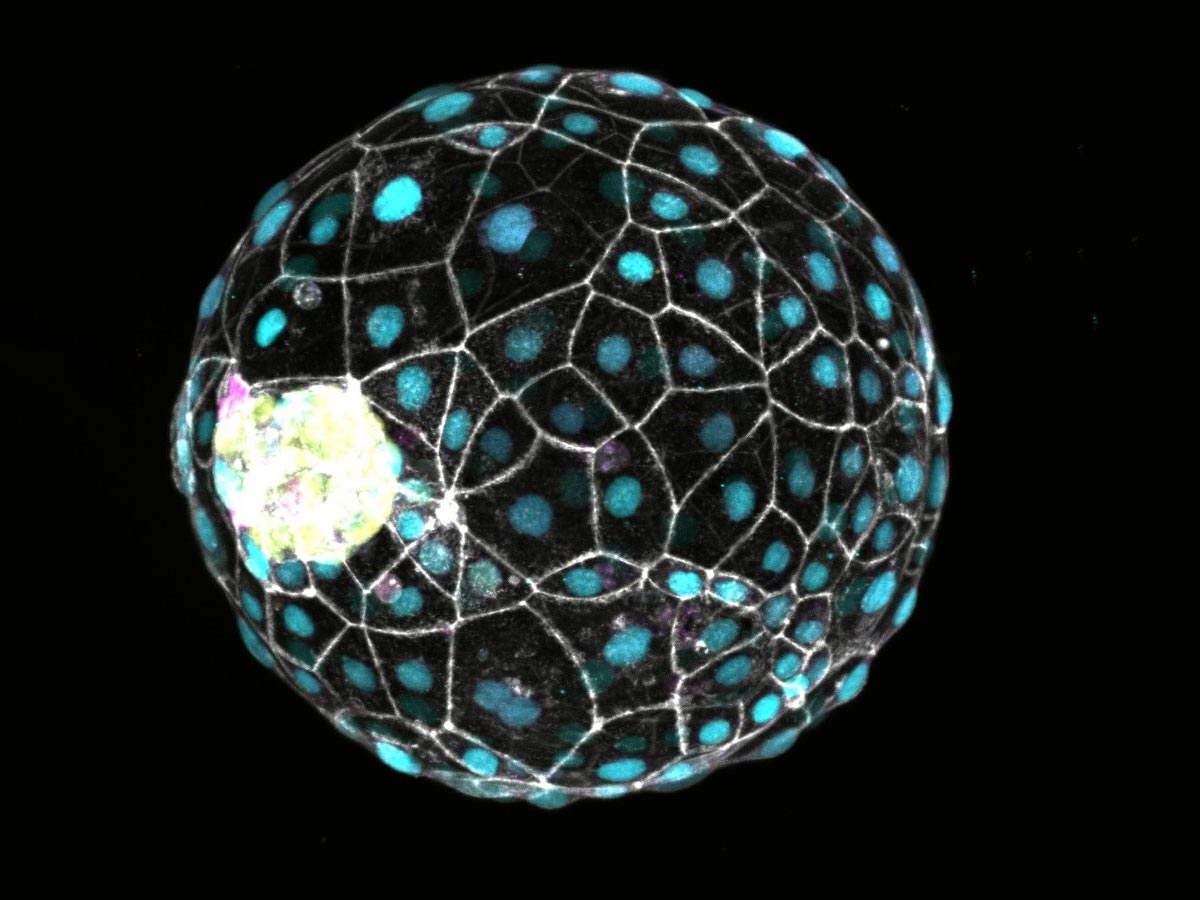 Hitting Pause on Life: Researchers Discover How to Delay Human Embryo ...