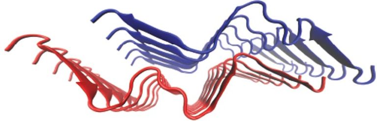 Decoding Alzheimer’s: The Arctic Mutation’s Role in Unusual Brain ...