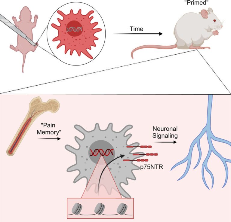 Immune Cells Carry a Long-Lasting “Memory” of Early-Life Pain