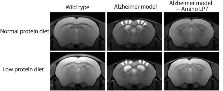 Essential Amino Acid Supplements Could Prevent Dementia