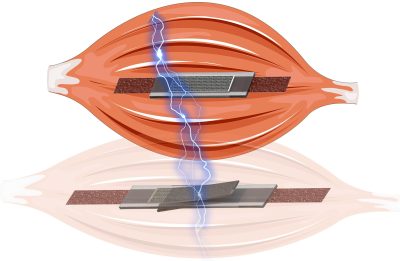 Bionic Breakthrough: Revolutionary Self-Sensing Electric Artificial Muscles