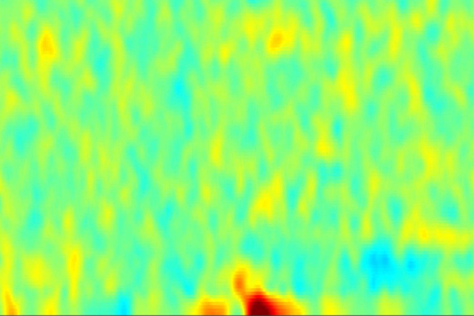 New Research Uncovers That Everyone’s Brain Has a Unique “Pain Fingerprint”
