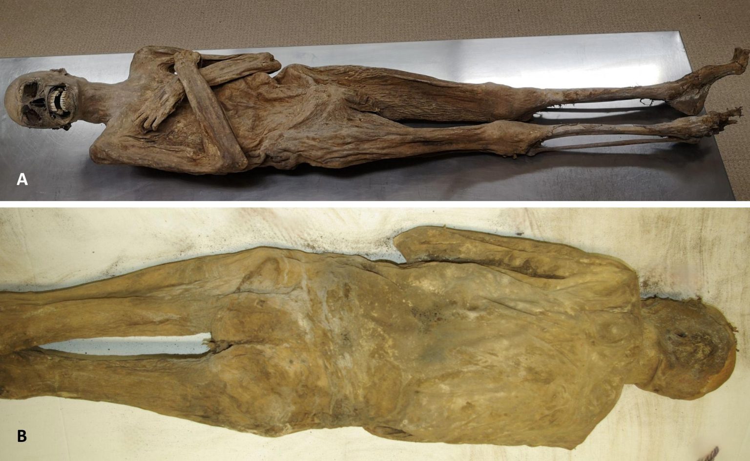 Researchers Discover “Unusually Well-Preserved” Mummy in Church Crypt