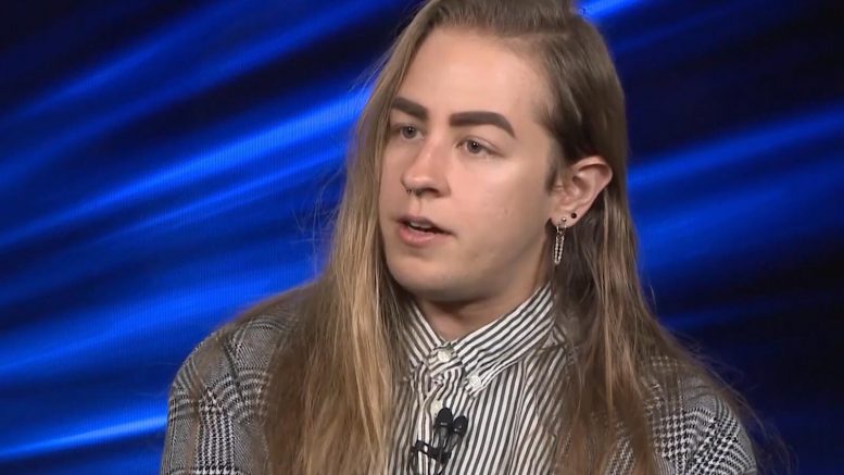 “Habsburg Jaw” Facial Deformity in Royal Dynasty Linked to Inbreeding