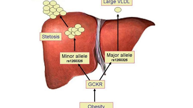Scientists Reverse Type 2 Diabetes and Fatty Liver Disease