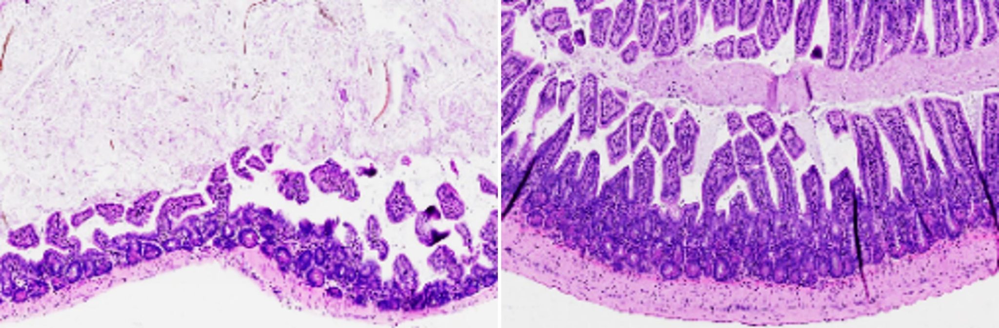 New Compound Reverses Gut Inflammation – Acts Like a Master Reset ...