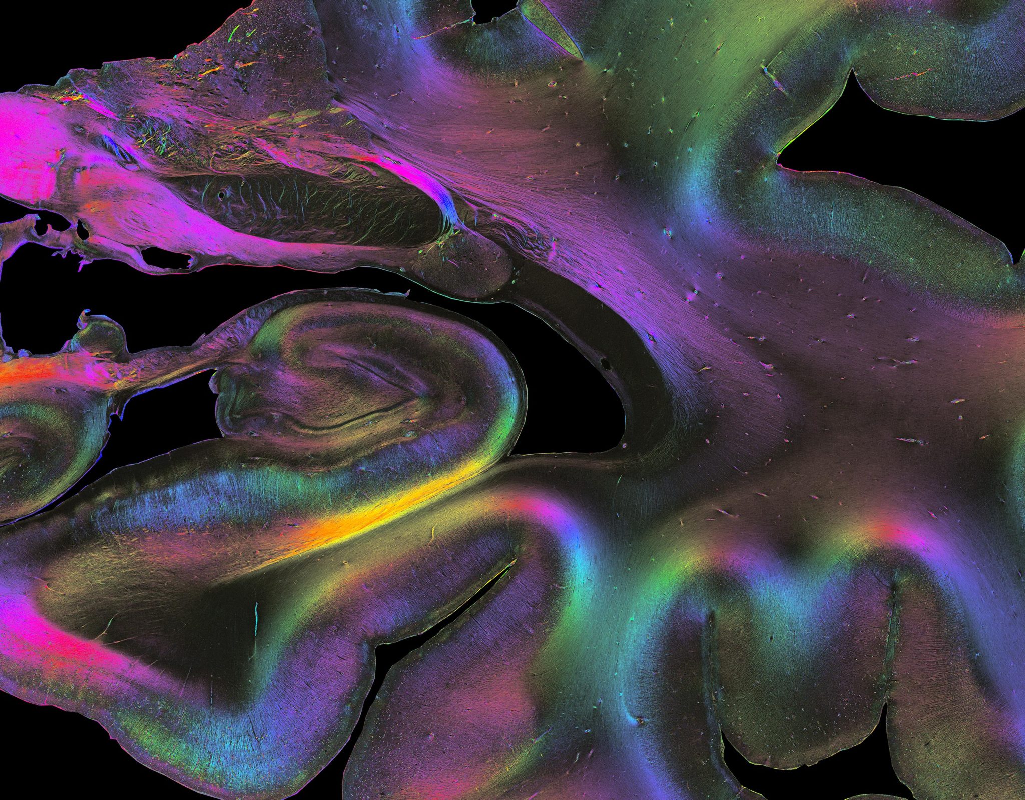 The Human Brain Project: Bridging Micro and Macro Understandings of the ...