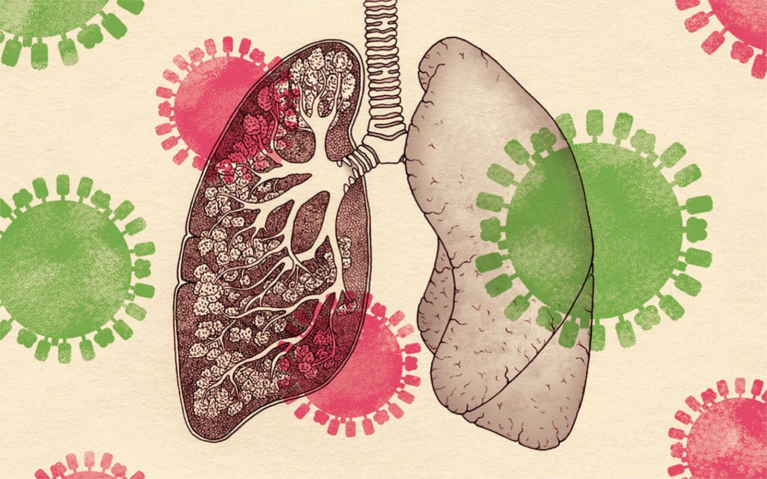 A New Hope for Protection Against Flu Damage Inside the Lungs