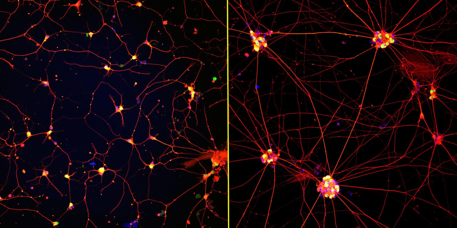 Mature “Lab Grown” Neurons Hold Promise for Neurodegenerative Diseases ...