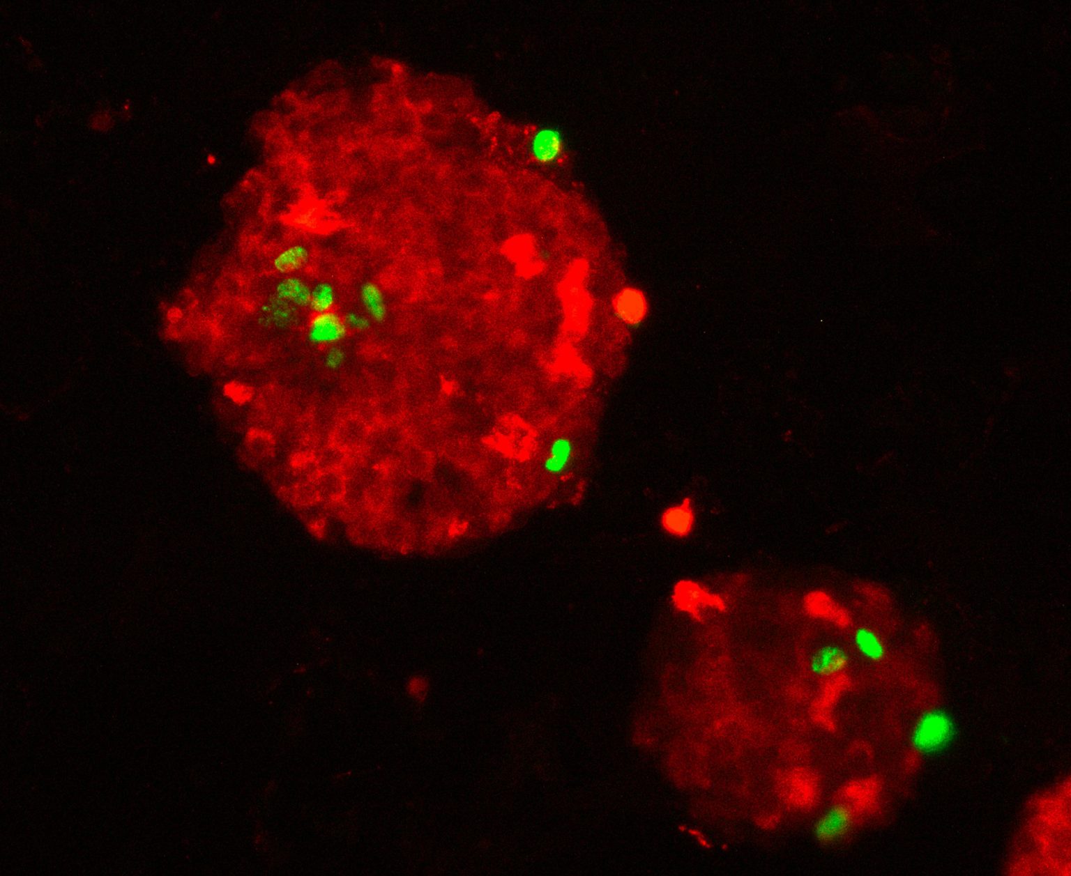 Reducing Diabetes Risk by 85%: Scientists Discover Infant Gut Bugs That ...