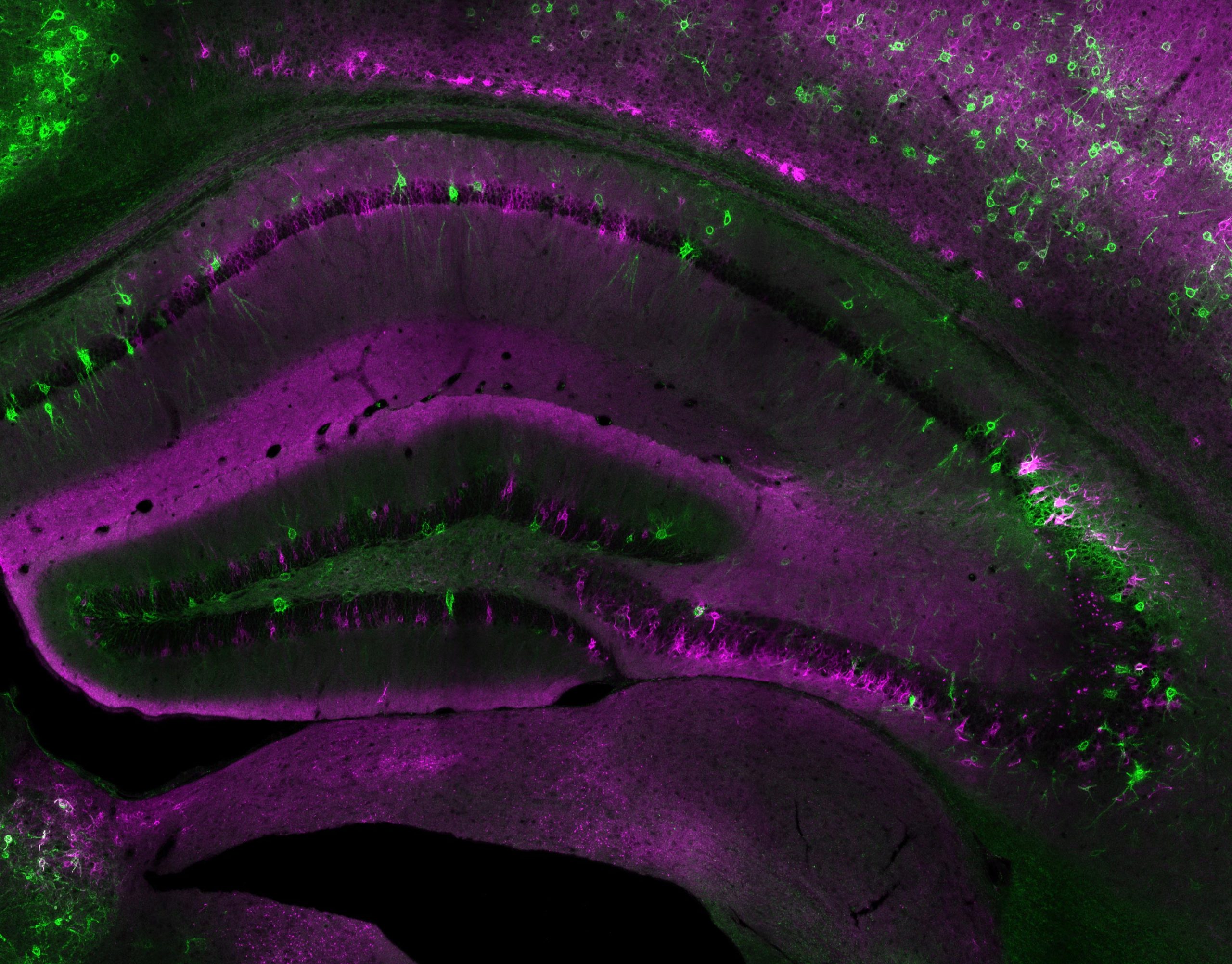 Illuminating the Brain’s Hidden Scaffold: New Insights From ECM Research