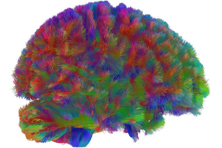 Your Brain Has Five Secret Ages, and One Lasts Most Of Your Life