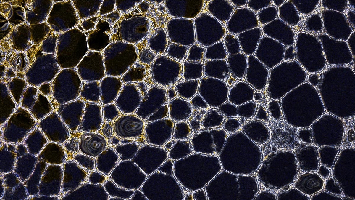 Unlocking the Secrets of Fat Tissue: The Inflammatory Response in Obesity