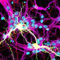 COVID-19 Can Cause Brain Cells To Fuse – Leading to Chronic “Long COVID ...