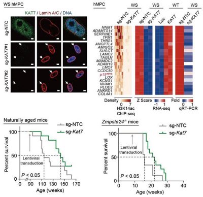 Scientists Develop New Gene Therapy Strategy to Delay Aging and Extend ...