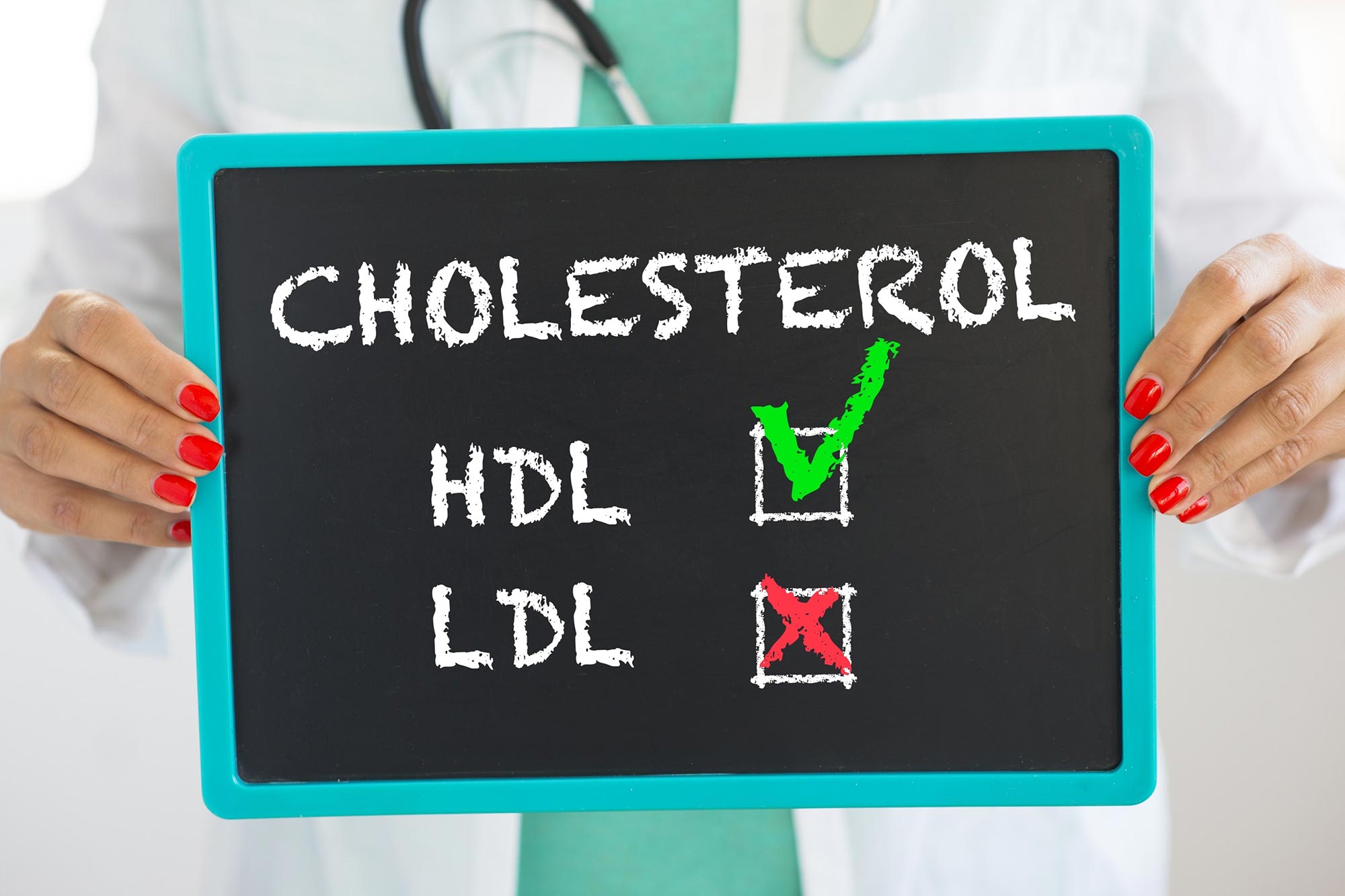 Small HDL “Good Cholesterol” Particles May Help Protect Against ...