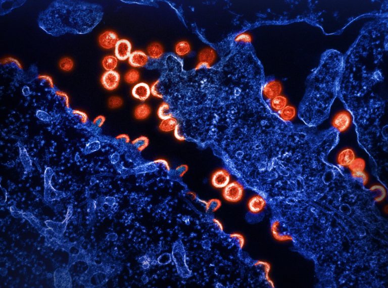 Unlocking the Immune Chain Reaction: Surprising Findings in HIV Vaccines