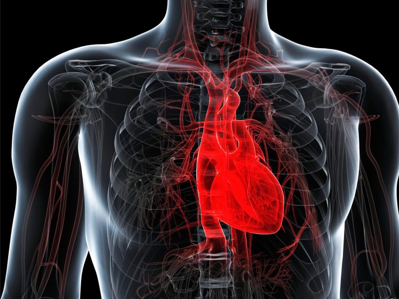 Human Heart With Heart Disease