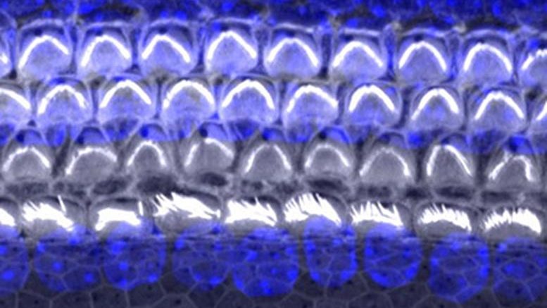 Restoring Hearing: New Tool To Create Ear Hair Cells Lost Due to Aging ...