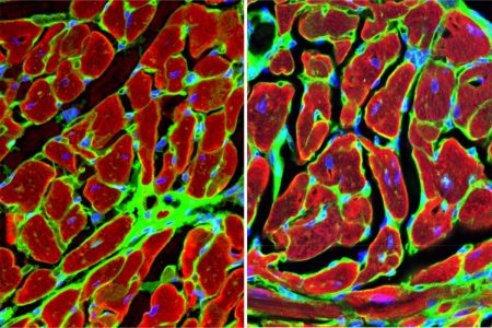 UCLA Scientists Discover Protein That Repairs Heart Damage
